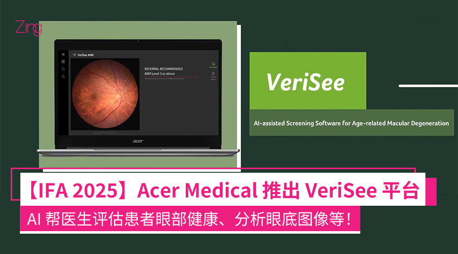 【IFA 2025】Acer Medical 推出 VeriSee 平台：可筛查眼科疾病、用AI技术分析眼底图像等！ - Zing Gadget